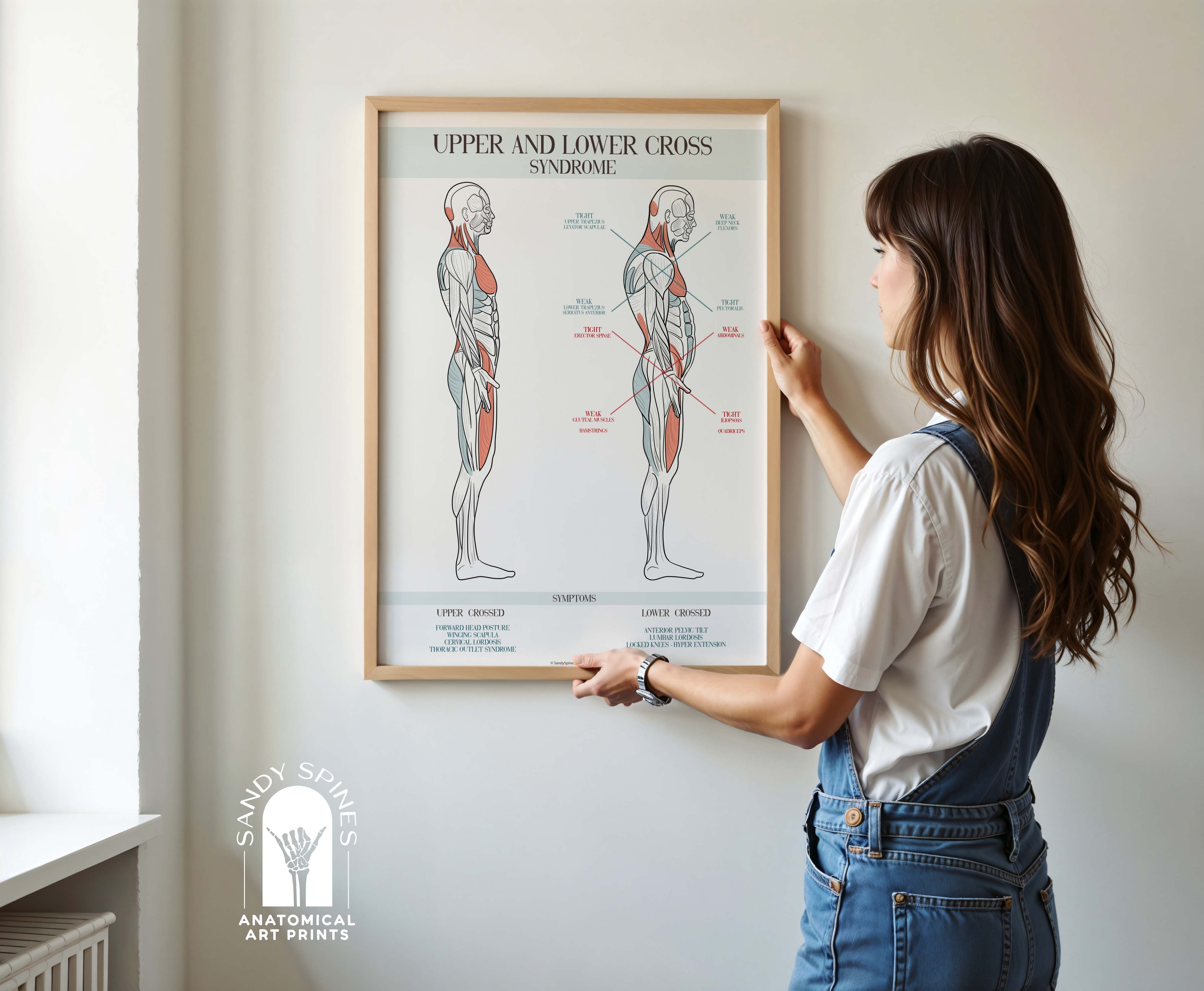 Chiropractic & Physical Therapy Anatomy Posters – SandySpines
