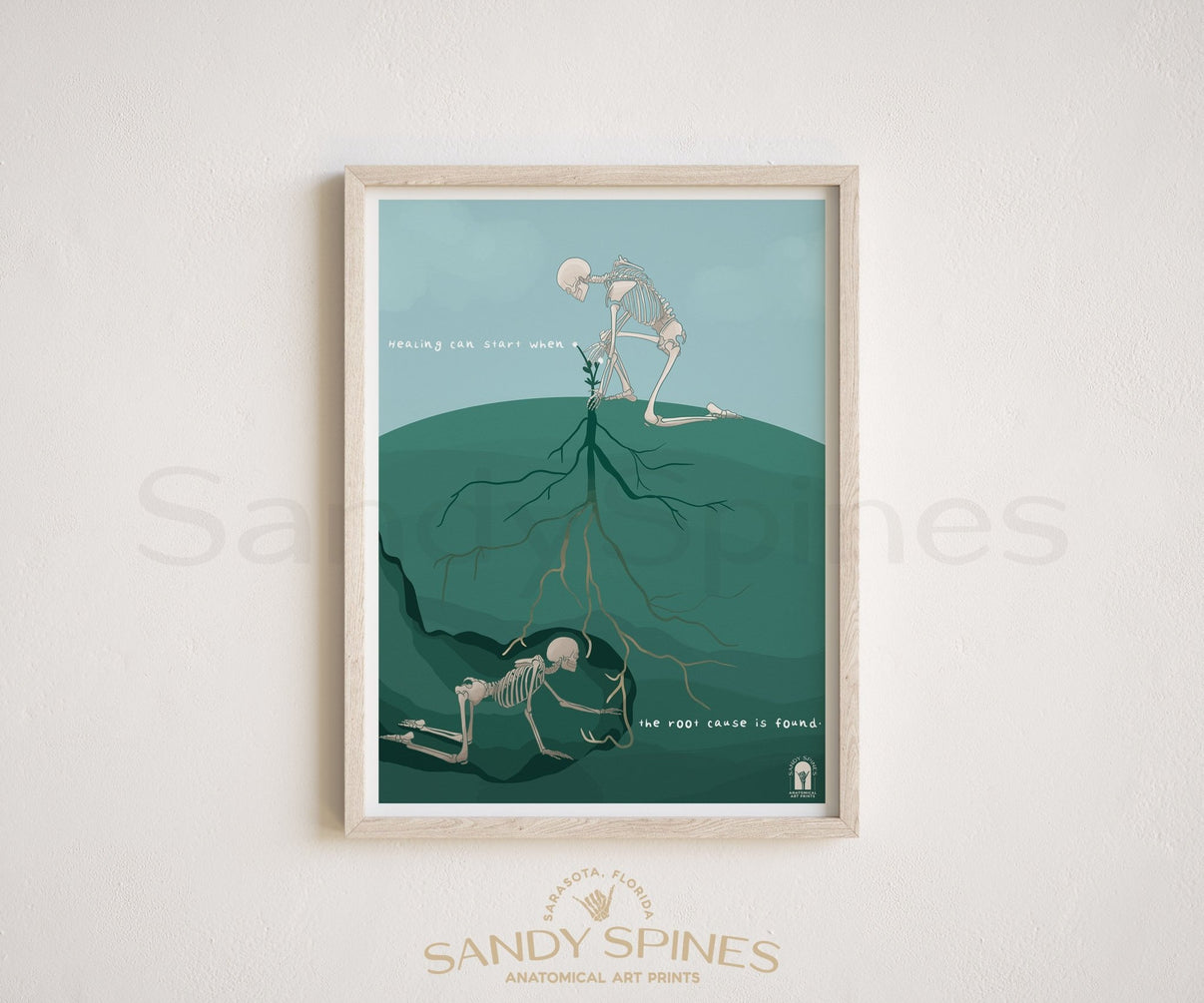 Root Cause | Anatomy Poster for Chiropractors & PTs – SandySpines