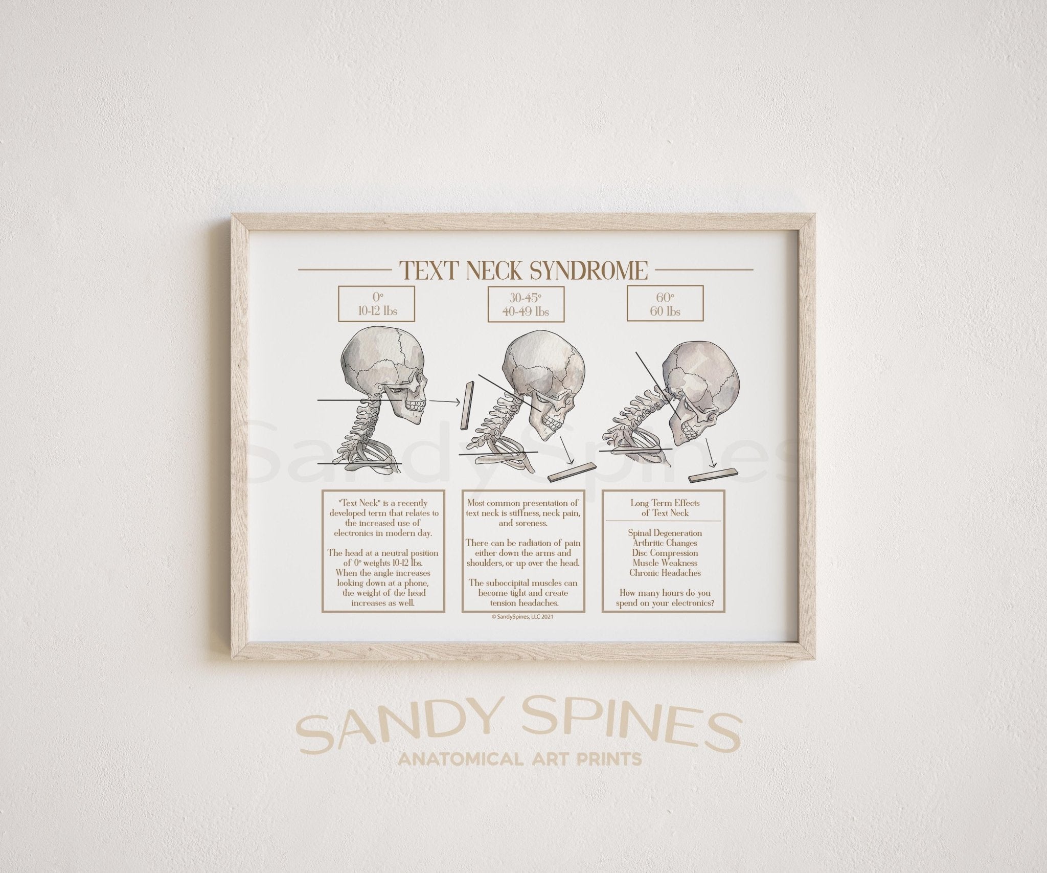 Text Neck Poster | Anatomy Poster for Chiropractors & PTs – SandySpines