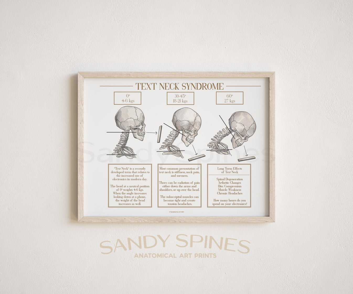 Text Neck Poster | Anatomy Poster for Chiropractors & PTs – SandySpines