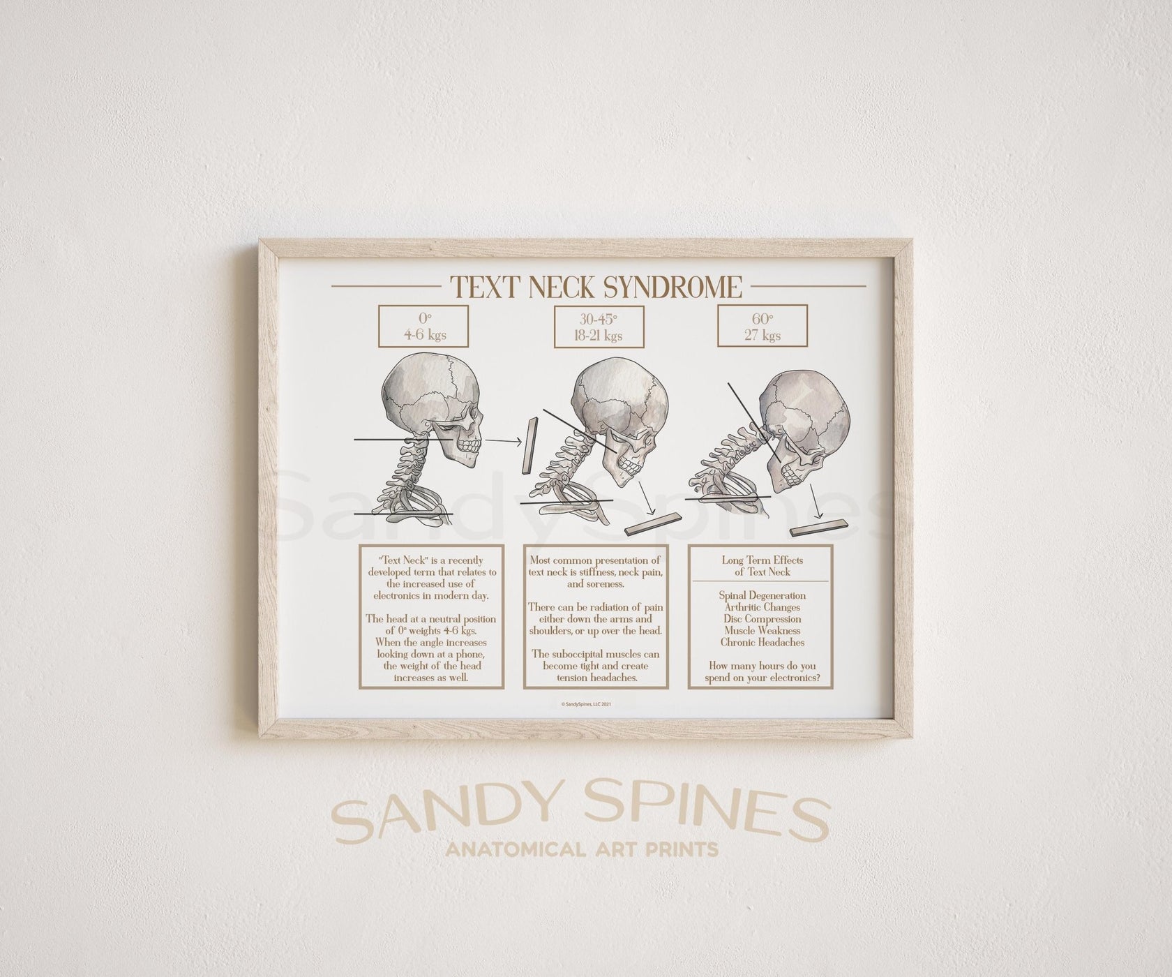 Text Neck Poster | Anatomy Poster for Chiropractors & PTs – SandySpines