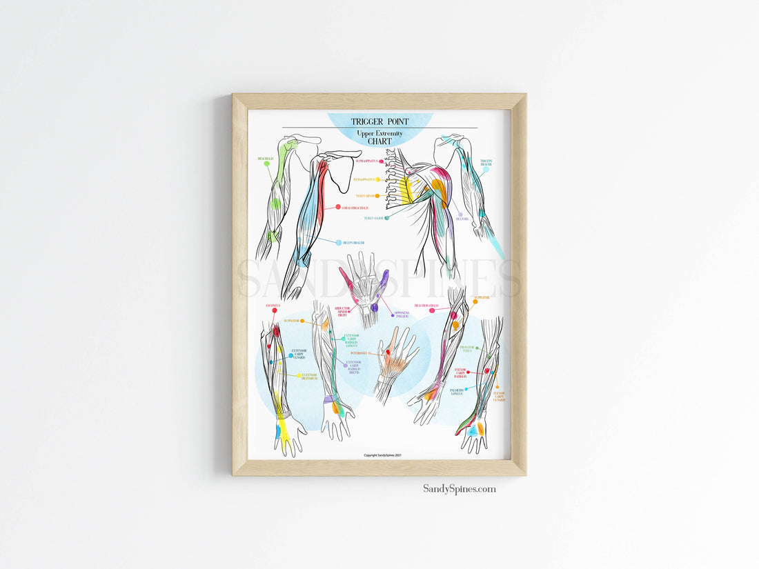 Trigger Point Charts | Set of 3 Posters – SandySpines