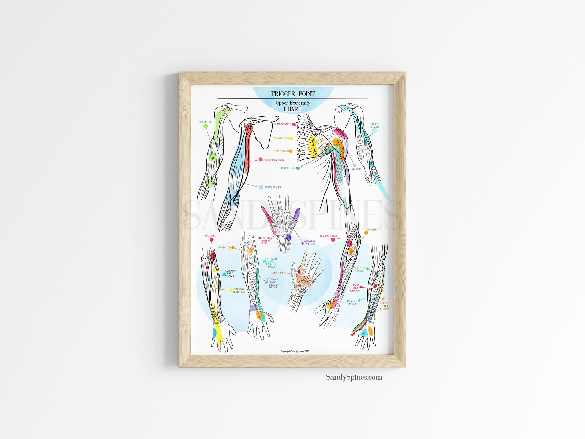Trigger Point Charts | Set of 3 Posters | SandySpines