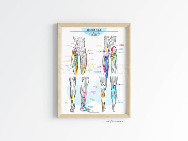 Trigger Point Lower Extremity Poster for Chiropractors & PT – SandySpines
