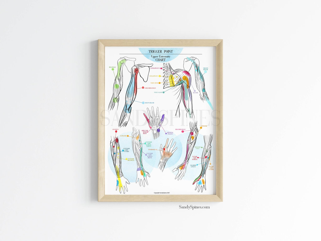 Trigger Point Upper Extremity Poster For Chiropractors Pt Sandyspines