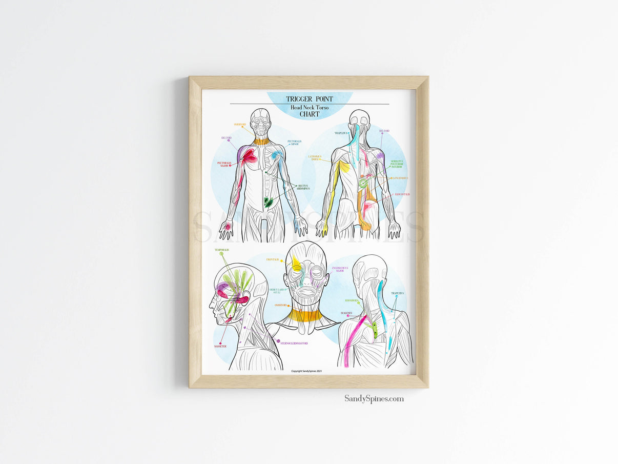 Trigger Point Charts | Set of 3 Posters – SandySpines