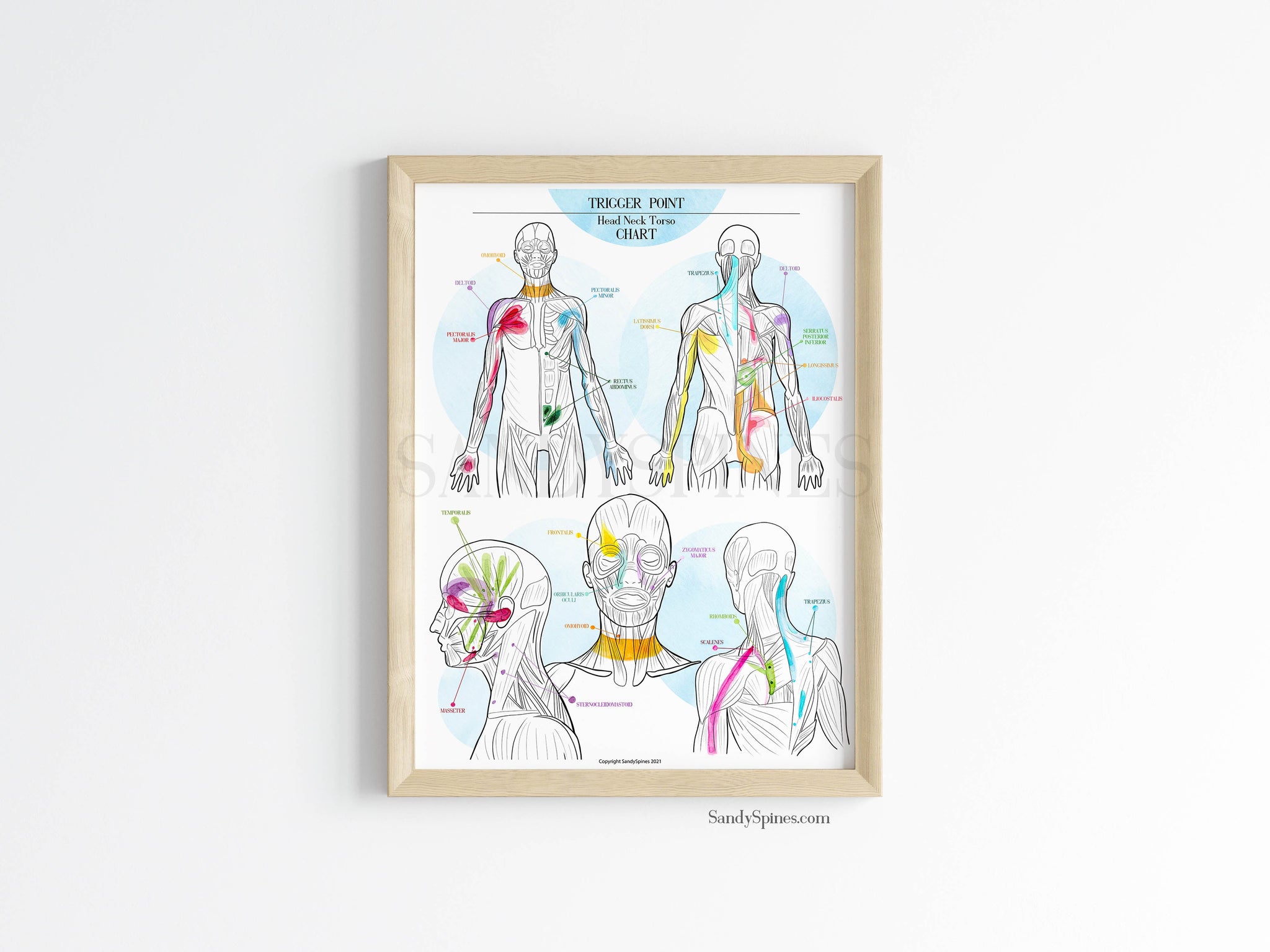 Trigger Point Charts | Set of 3 Posters | SandySpines